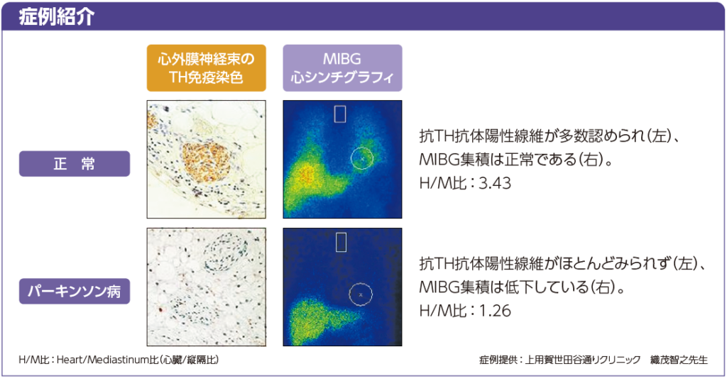 ミオMIBG®-I123注射液 - PDRファーマ株式会社